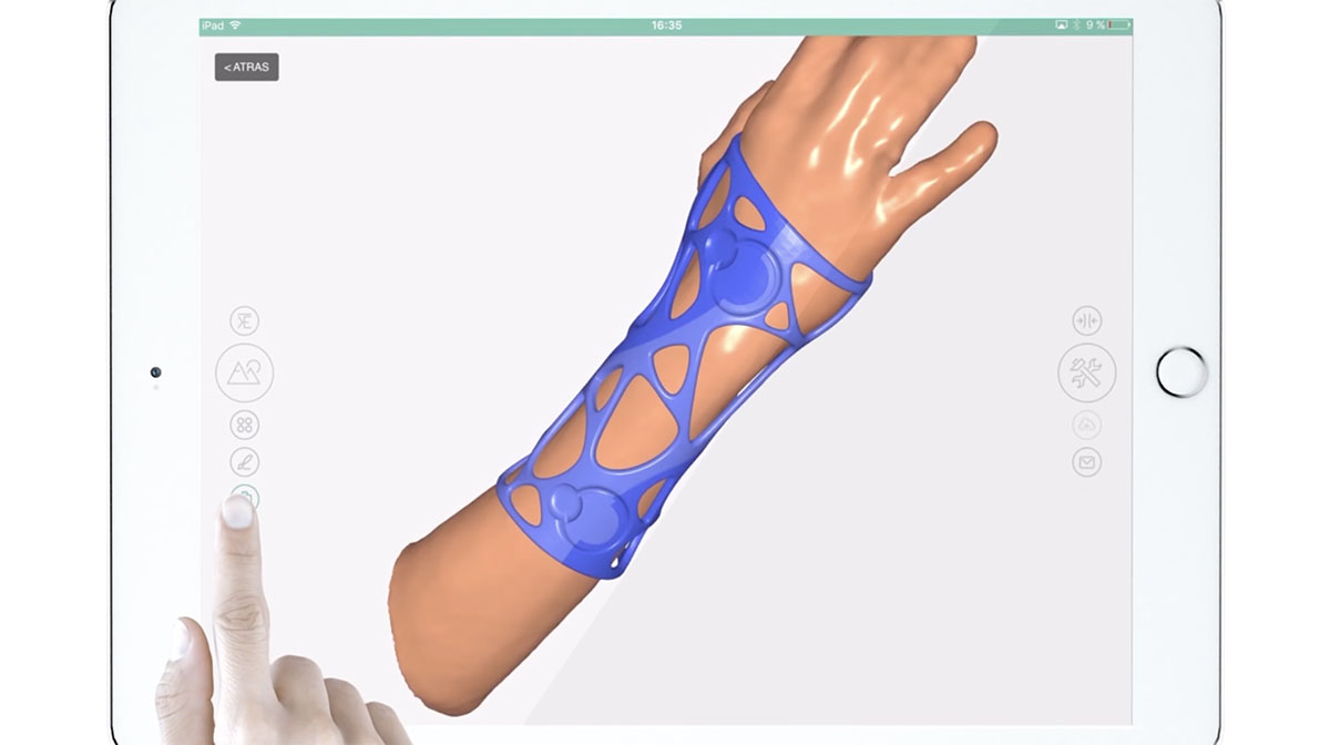 ギプスを3Dプリント？ 患部に合わせ3Dプリンターで製作する超快適なギプス「XKELET」 - bouncy / バウンシー