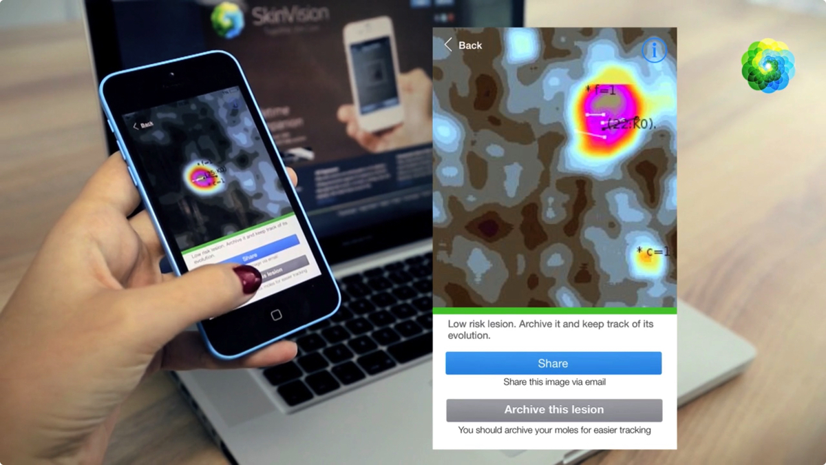 スマホで皮膚がんを早期発見できる医療アプリ「SkinVision」 - bouncy / バウンシー